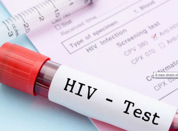 New Type of HIV Discovered - UPSC Current Affairs